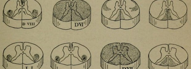 Google & Biogen Team to Use Wearable Sensors to Study Multiple ...