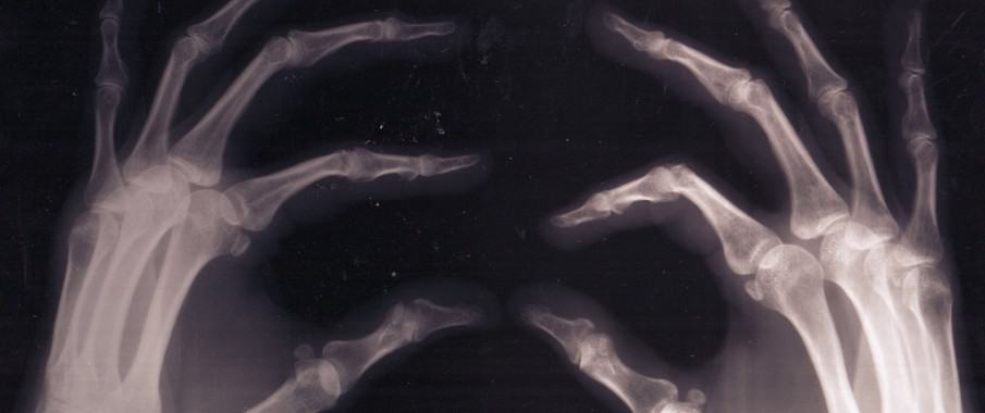 Open-Sourcing The Human Body With The "Open Humans" Platform - Dataconomy